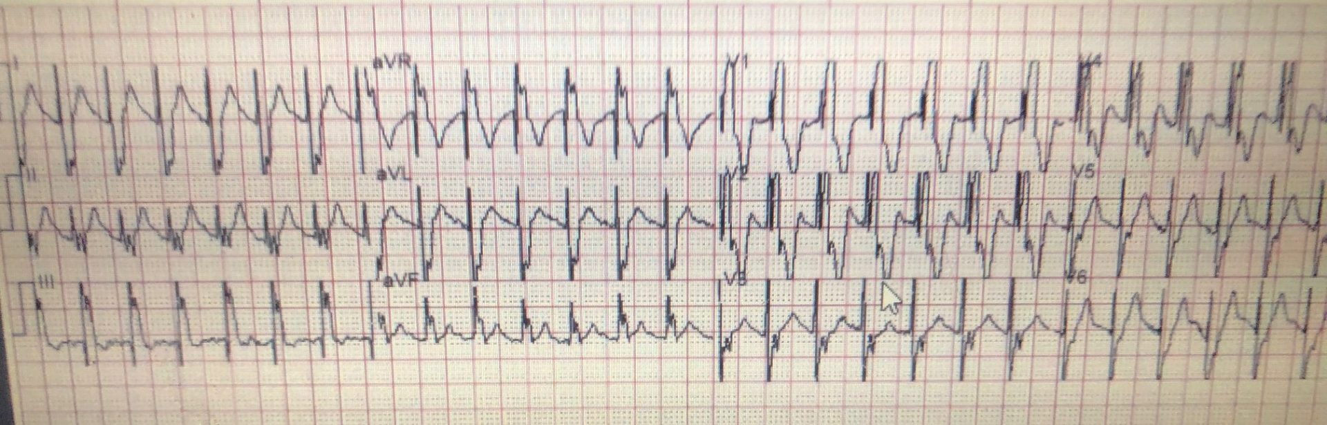 ecg-tof – SCOPE